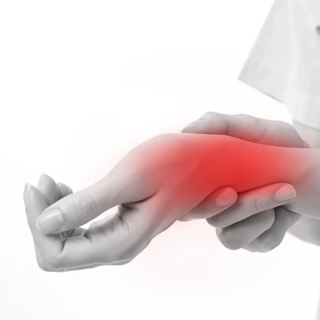 Wrist Sprain - Treatment & Recovery Options | Tensegrity